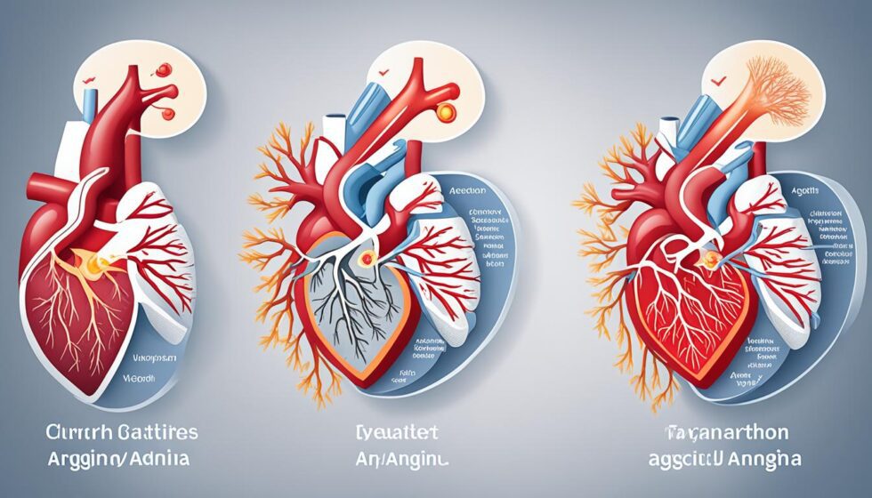 Qual o melhor remédio para angina?